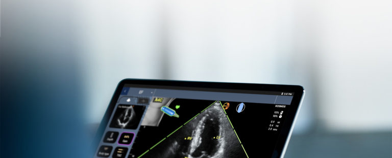 Point of Care Ultrasound Machines for Medical Offices | EchoNous