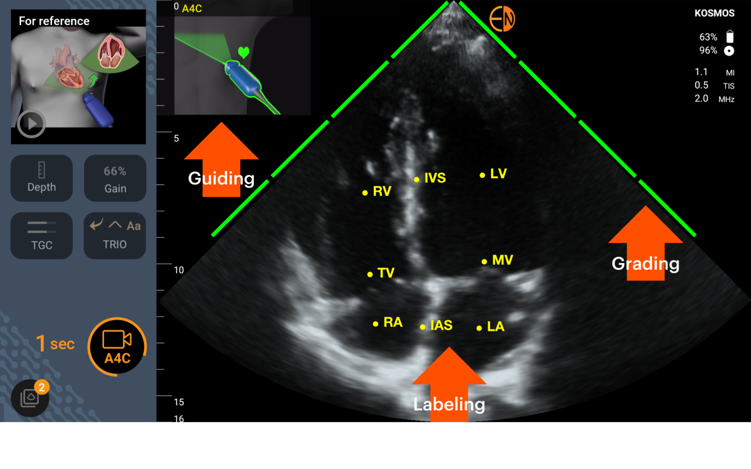 Kosmos AI - EchoNous