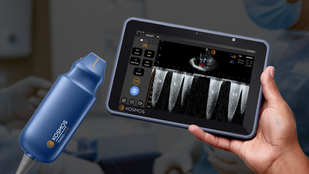 Cardiology - EchoNous