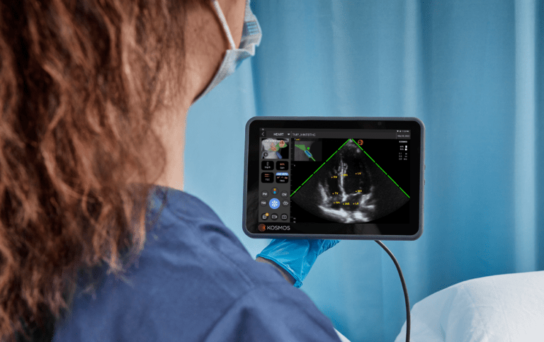 Teaching Cardiothoracic Anatomy With Ultrasound AI | EchoNous