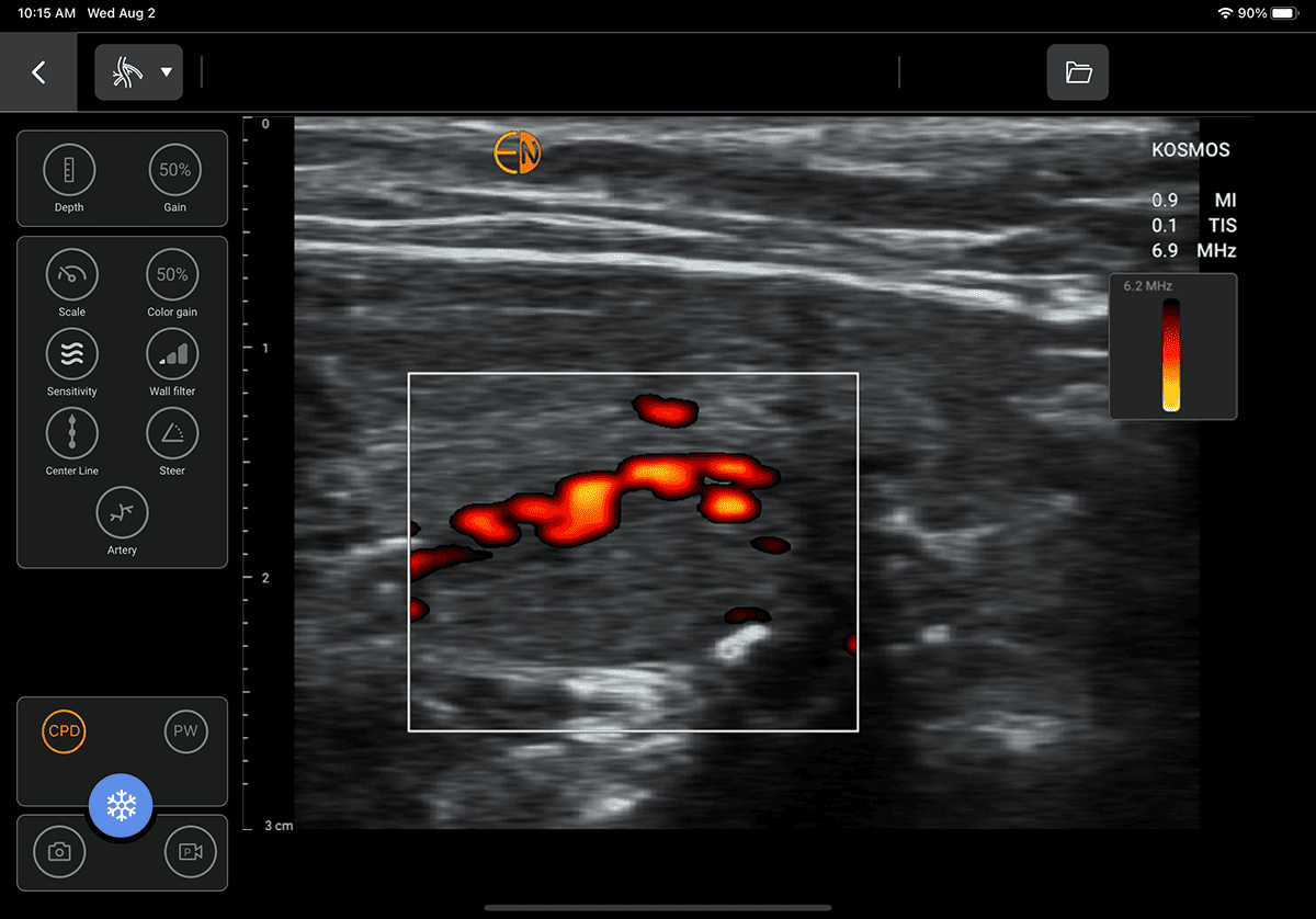 Kosmos Portable Ultrasound Machine - EchoNous