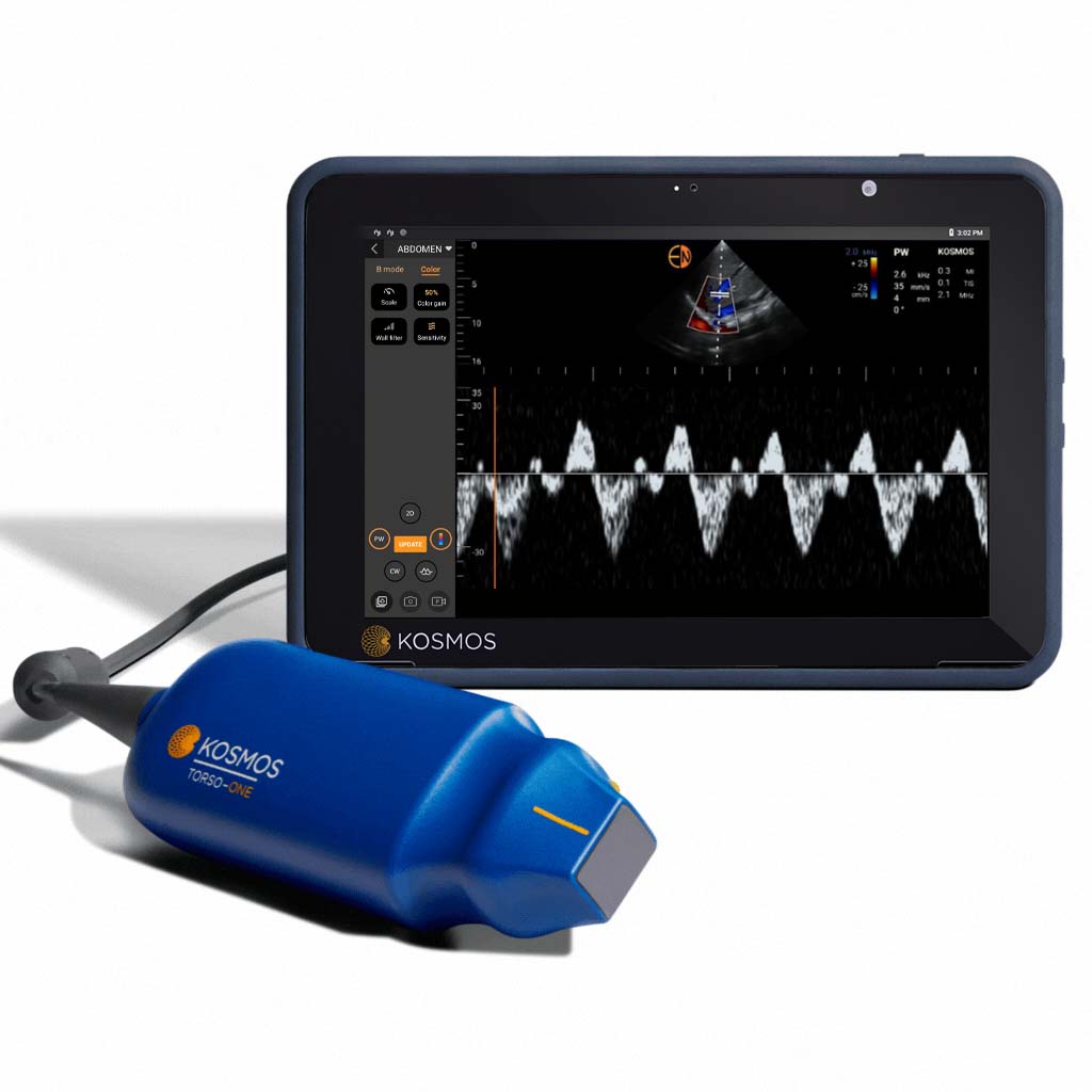 POCUS in Nephrology | EchoNous