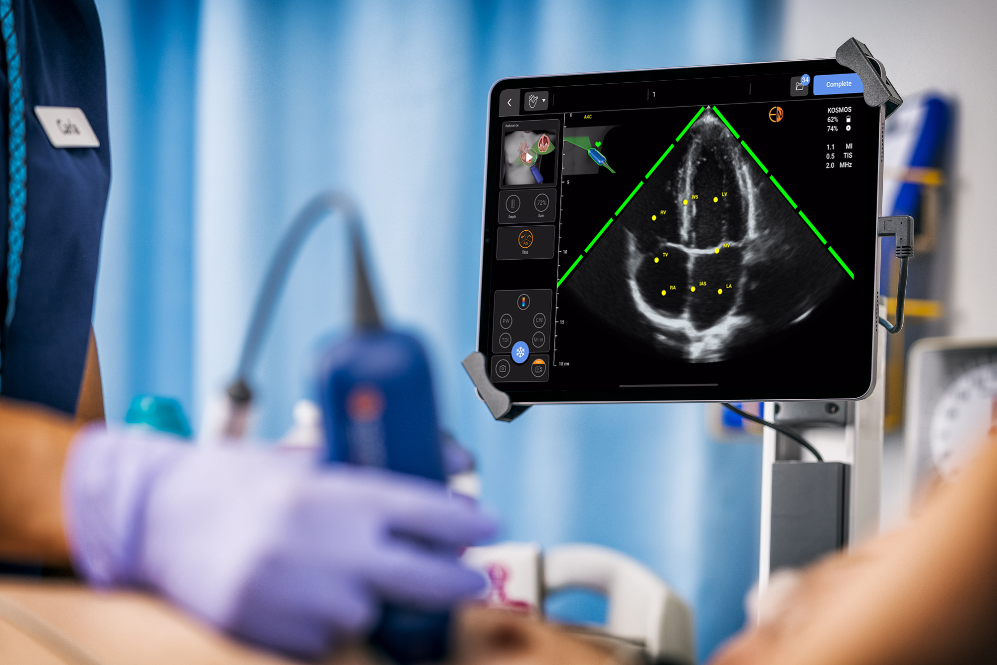 POCUS in Critical Care | EchoNous