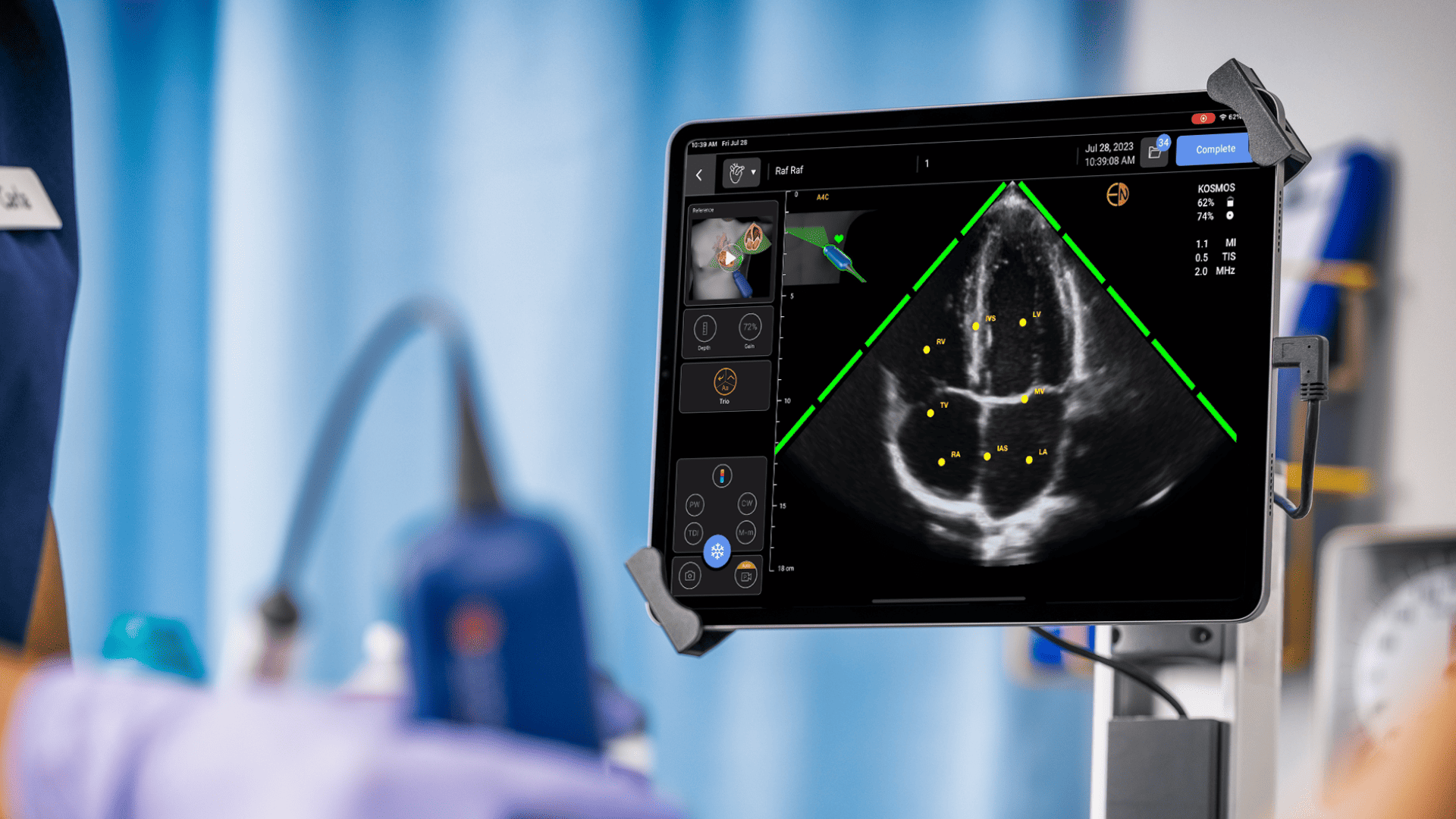Point of Care Ultrasound Technology (POCUS) With AI | EchoNous