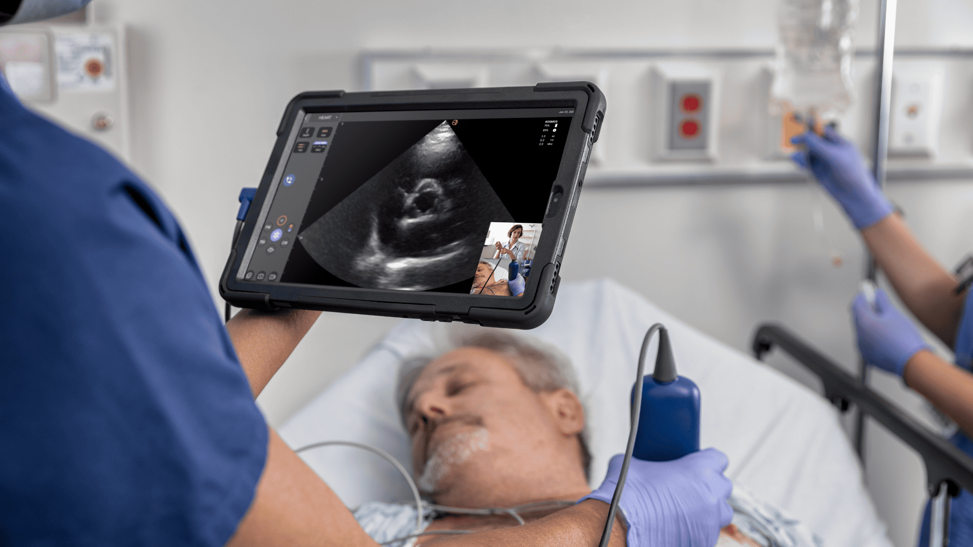Point of Care Ultrasound Technology (POCUS) With AI | EchoNous