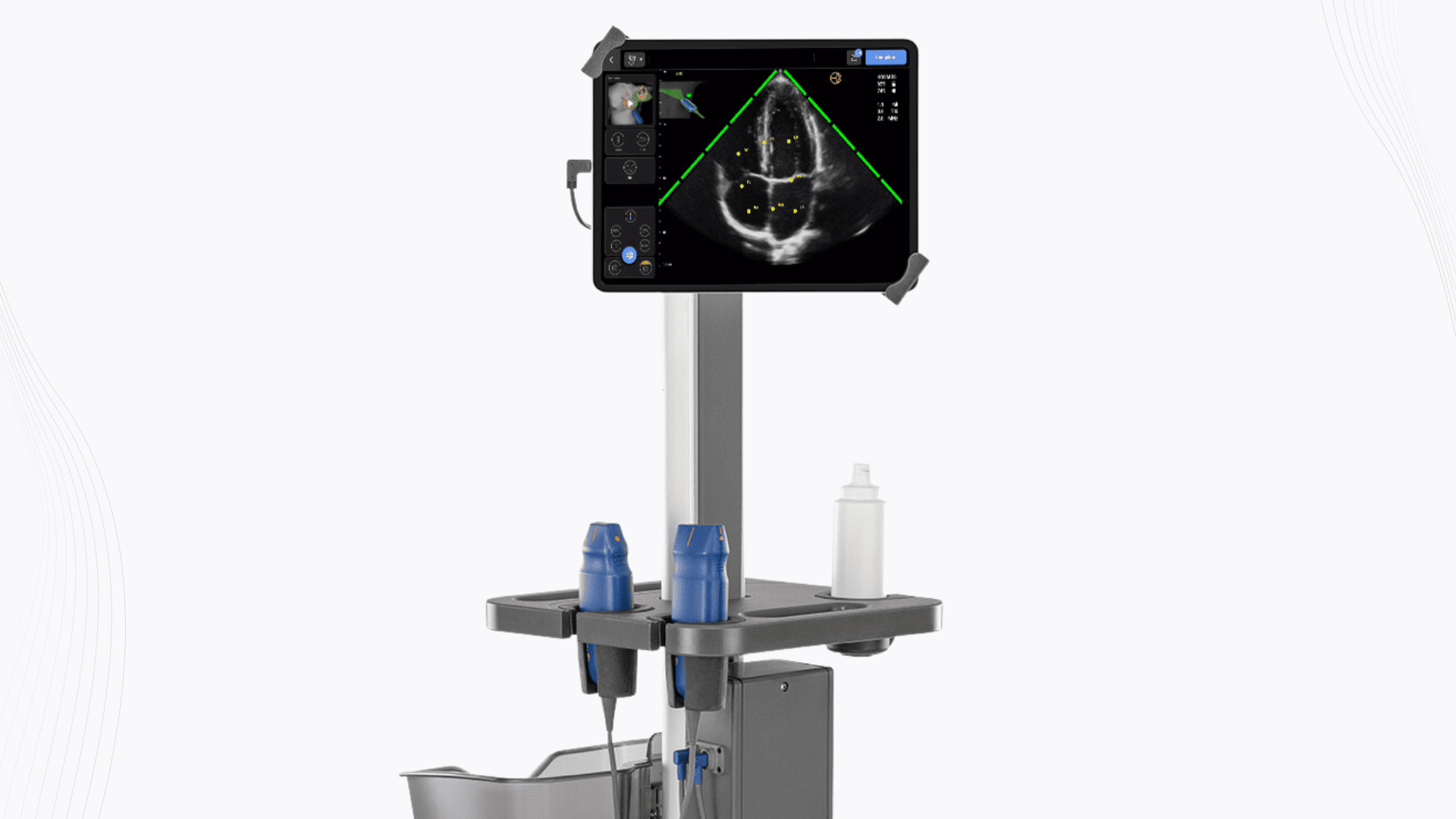 Point of Care Ultrasound Technology (POCUS) With AI | EchoNous