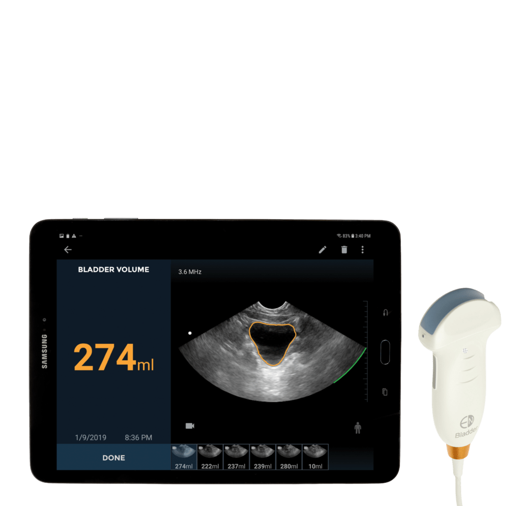 Point of Care Ultrasound Technology (POCUS) With AI | EchoNous