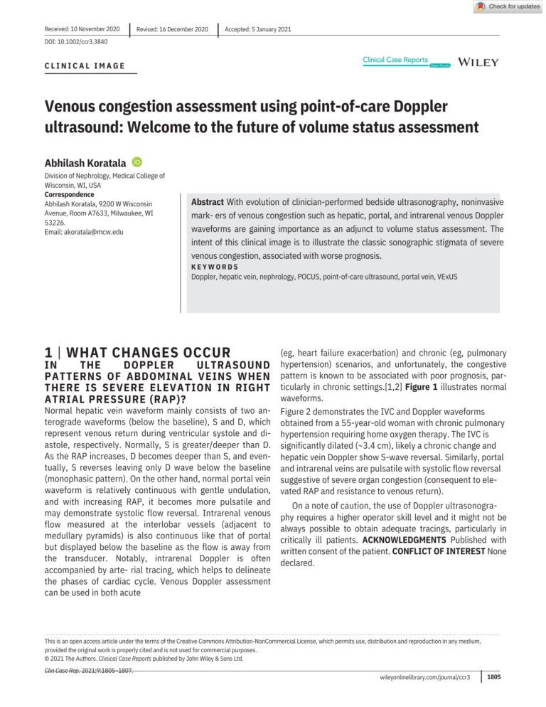 VExUS | Kosmos by EchoNous