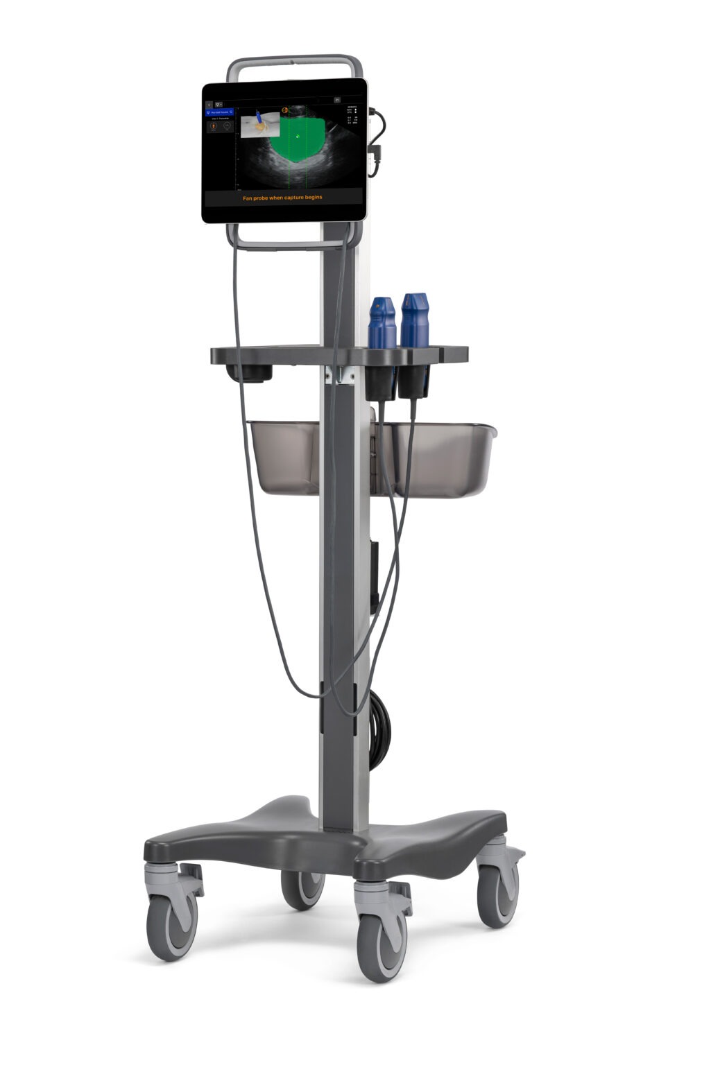 Kosmos AI-driven POCUS device