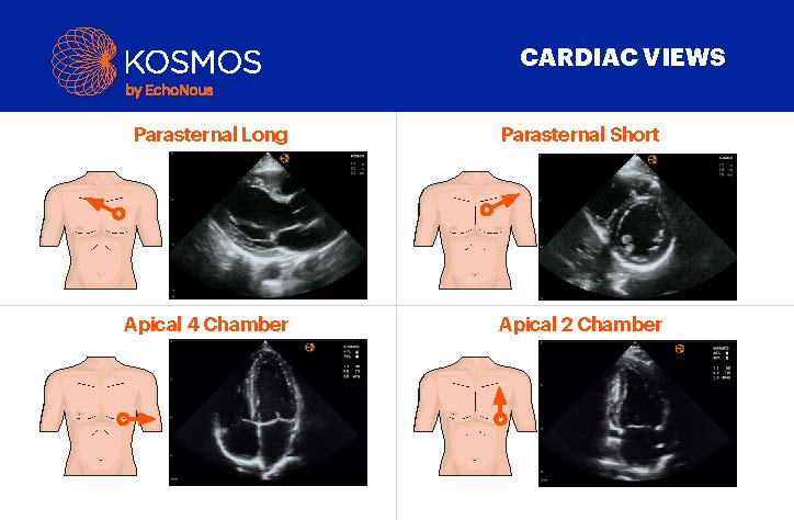 Cardiac and FAST Ultrasound Views | Kosmos by EchoNous