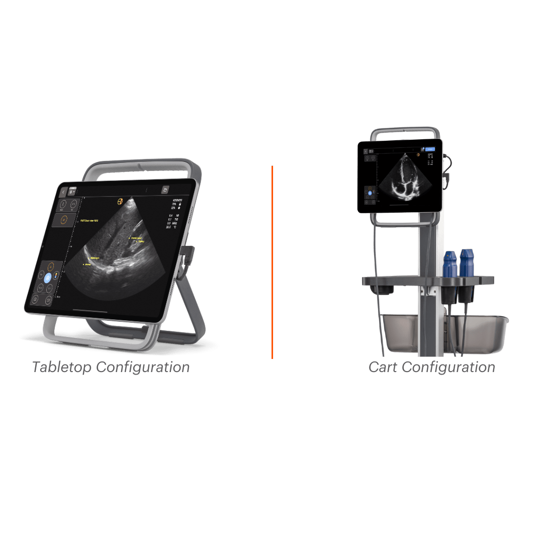 Kosmos AI-driven POCUS device