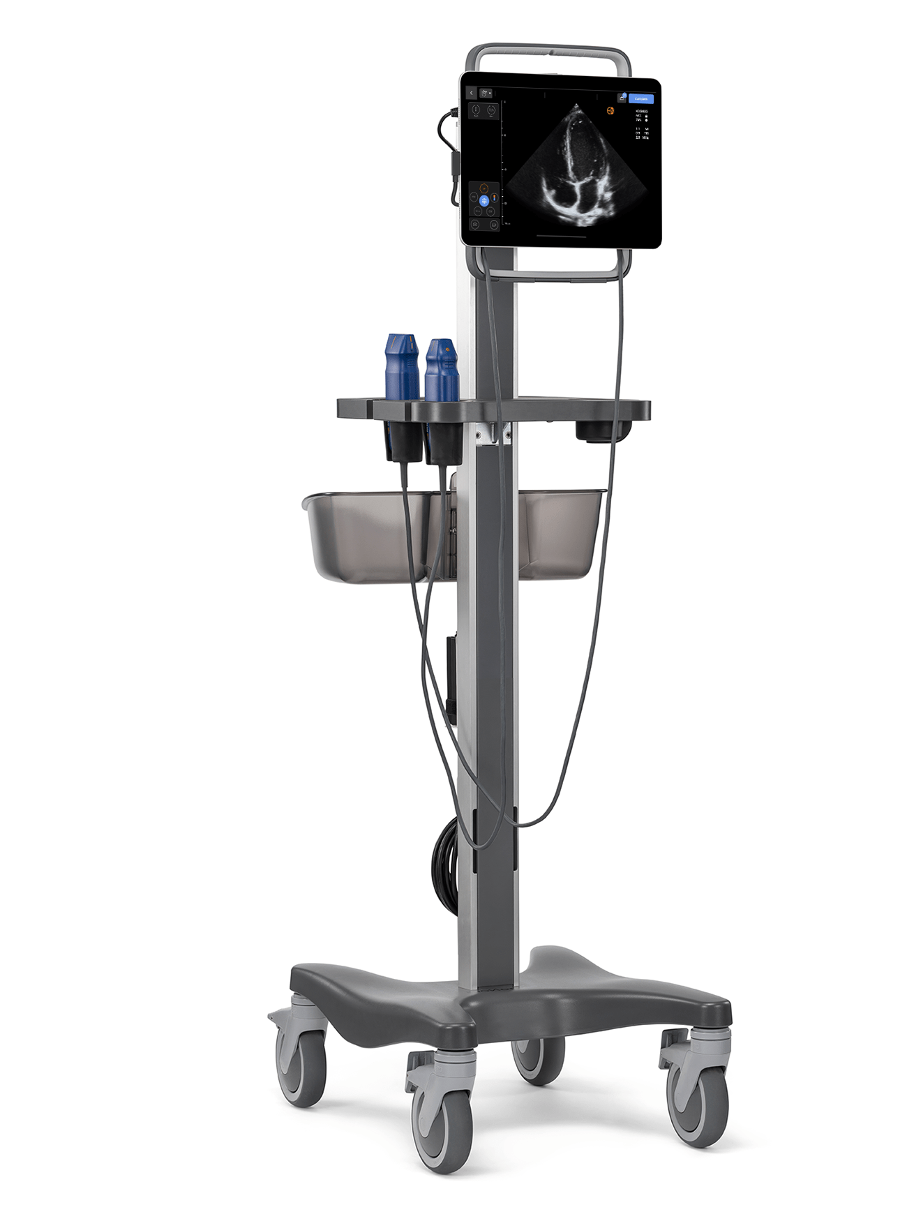 Kosmos AI-driven POCUS device